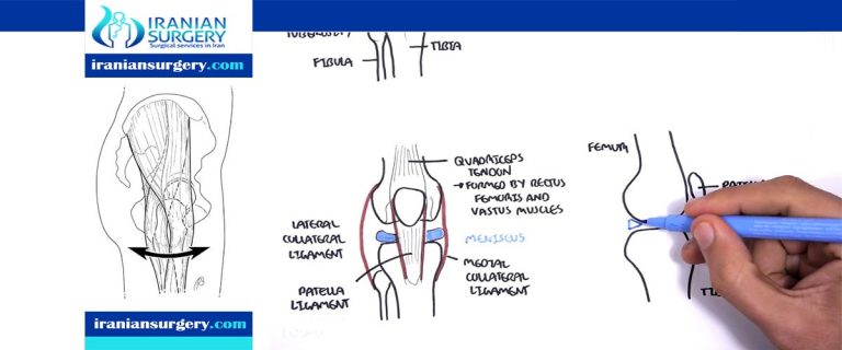 Knee arthroscopy orthobullets | Orthobullets knee arthroscopy