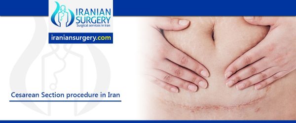 Section procedure | C section procedure step by step | Iranian Surgery