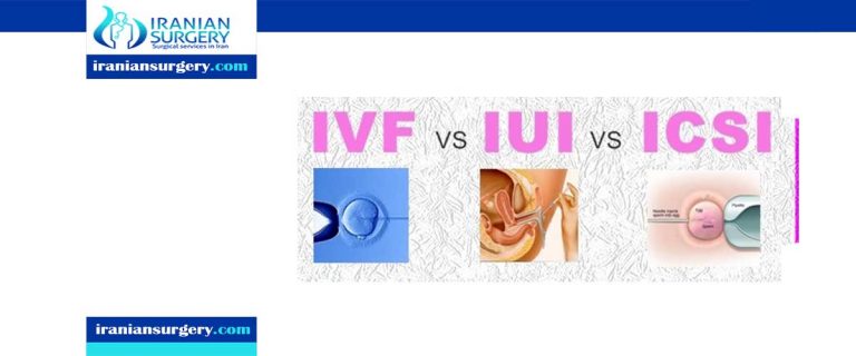IUI vs IVF | IUI vs IVF cost | icsi vs iui | iui vs icsi | Iranian Surgery
