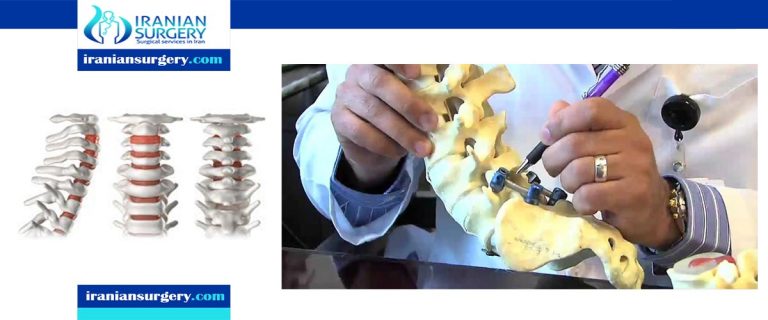 disk laminectomy | discectomy laminectomy | surgery | recovery