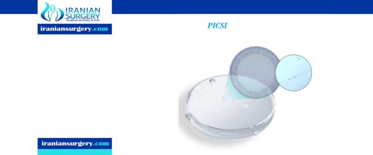Picsi | Ivf picsi | | picsi procedure | Picsi cost | Iranian Surgery