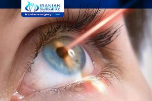 How much does prk cost? | What are the side effects of PRK eye surgery?