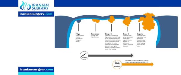Colorectal cancer surgery recovery | post colorectal surgery complications